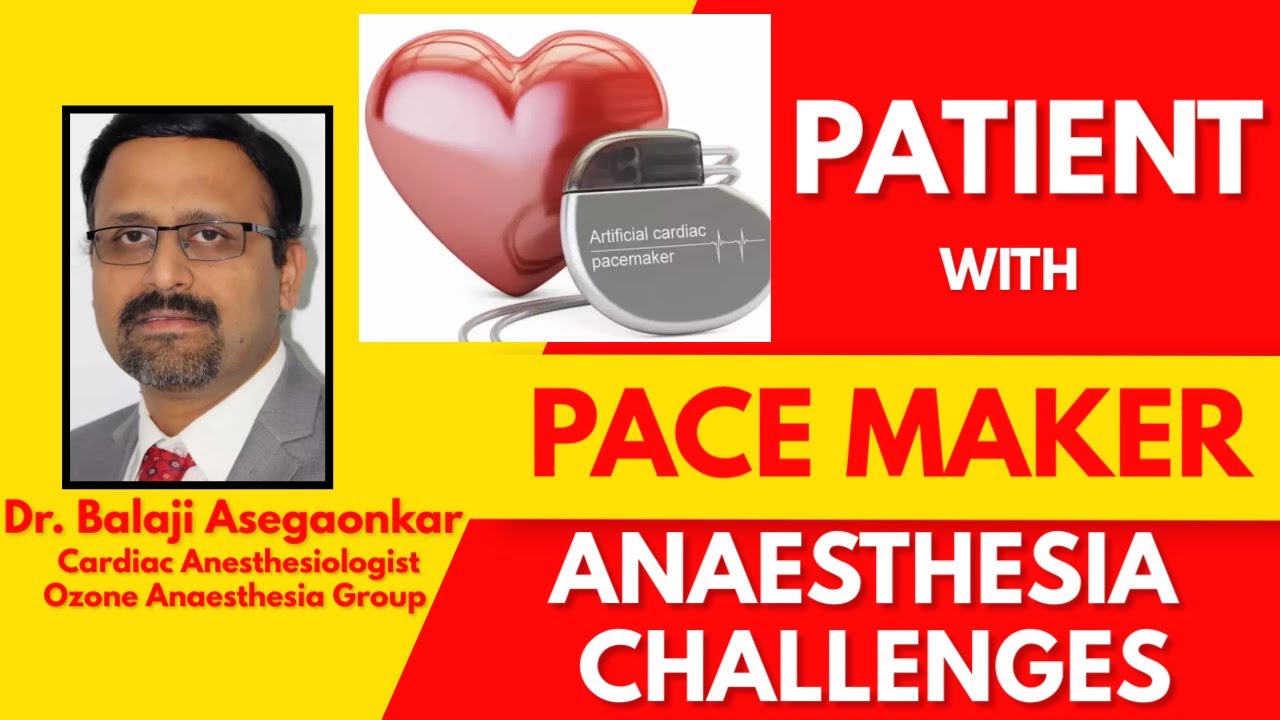 Anaesthesia Challenges In Patients With Pace Maker I Non cardiac ...