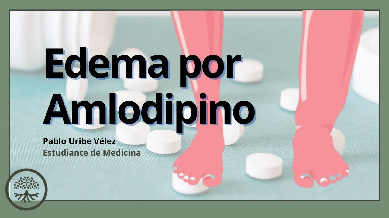 Edema por Amlodipino - YouTube