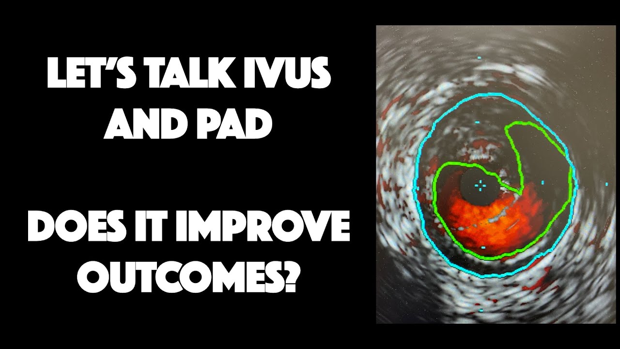 Let's Talk IVUS and PAD - YouTube