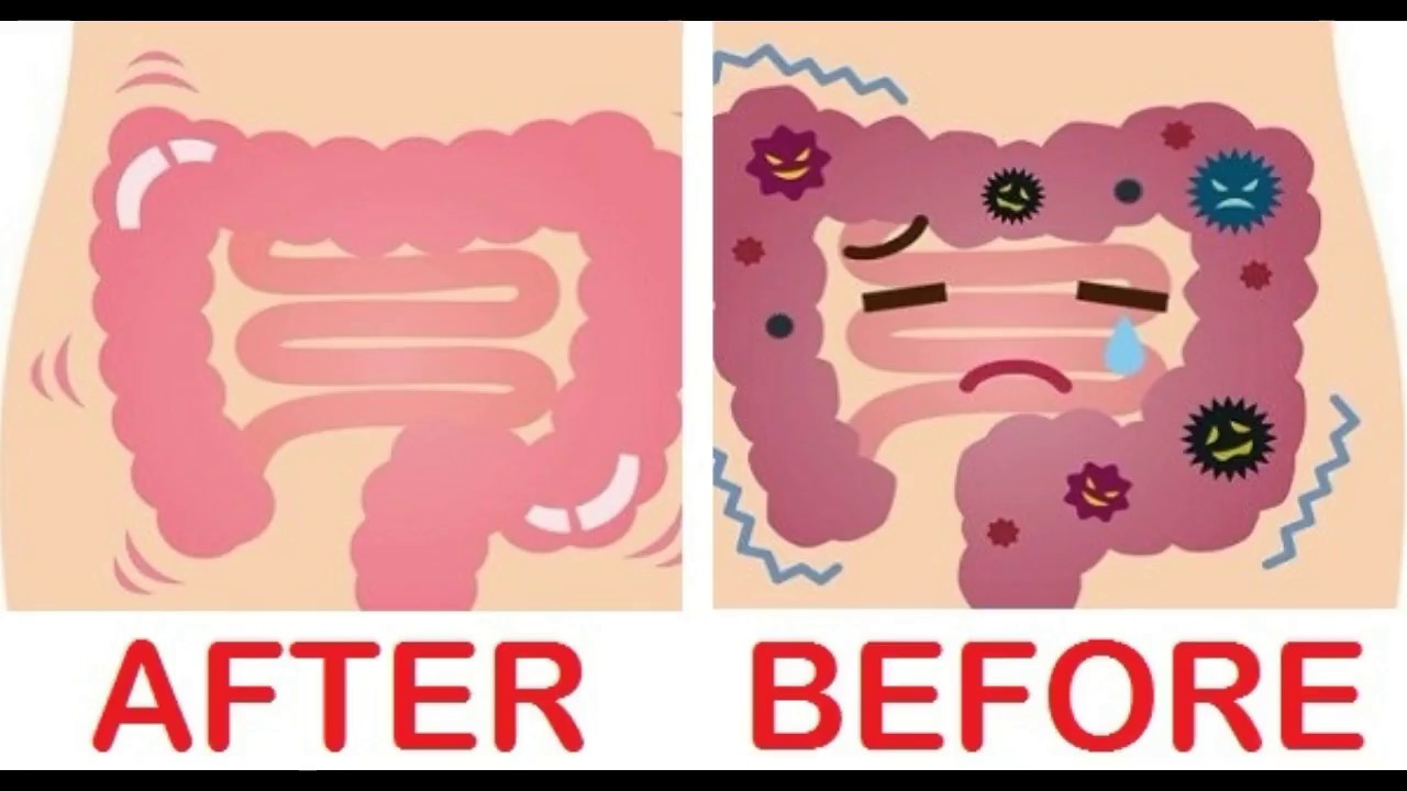 GET RID OF 20 POUNDS OF TOXINS FROM YOUR COLON WITH THESE 2 SIMPLE ...
