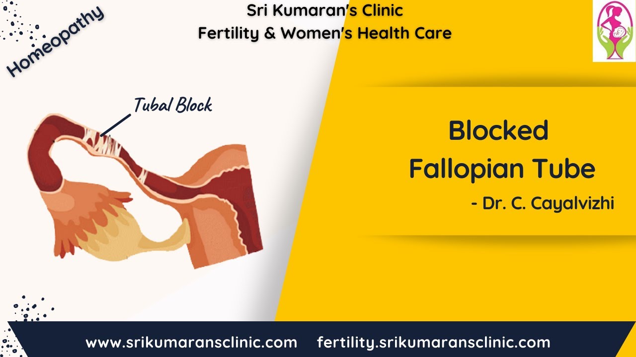 Blocked Fallopian Tube | Causes, Symptoms and Treatment | DR CAYALVIZHI ...