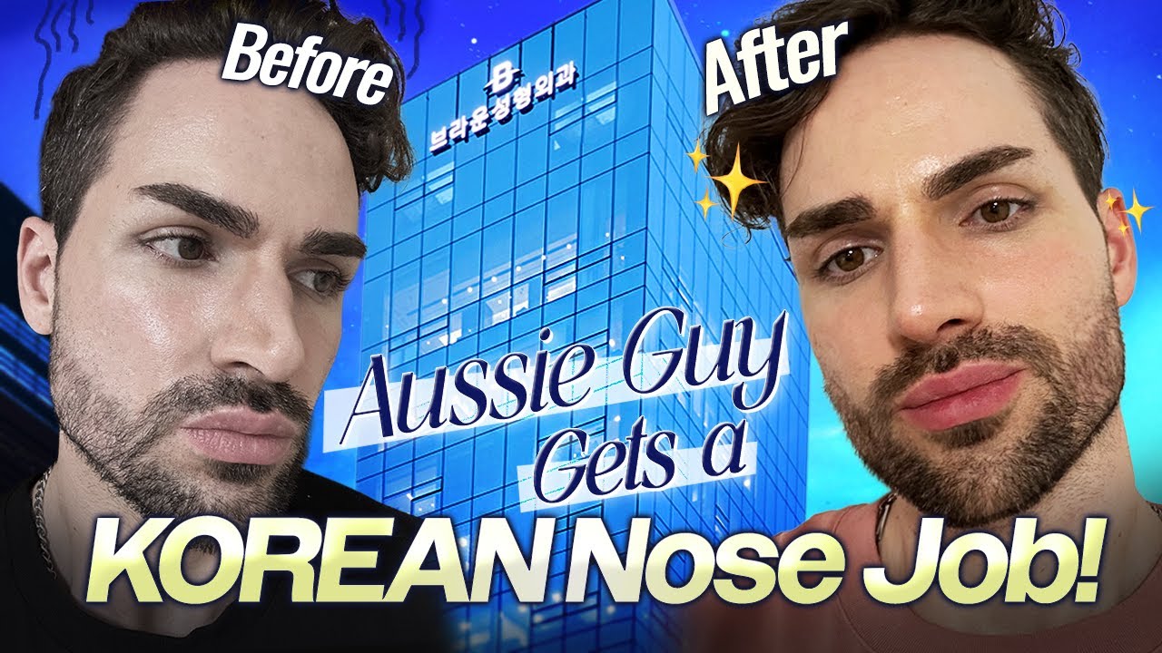 He Flew All the Way From Australia For THIS Nose Job… Worth It? - YouTube