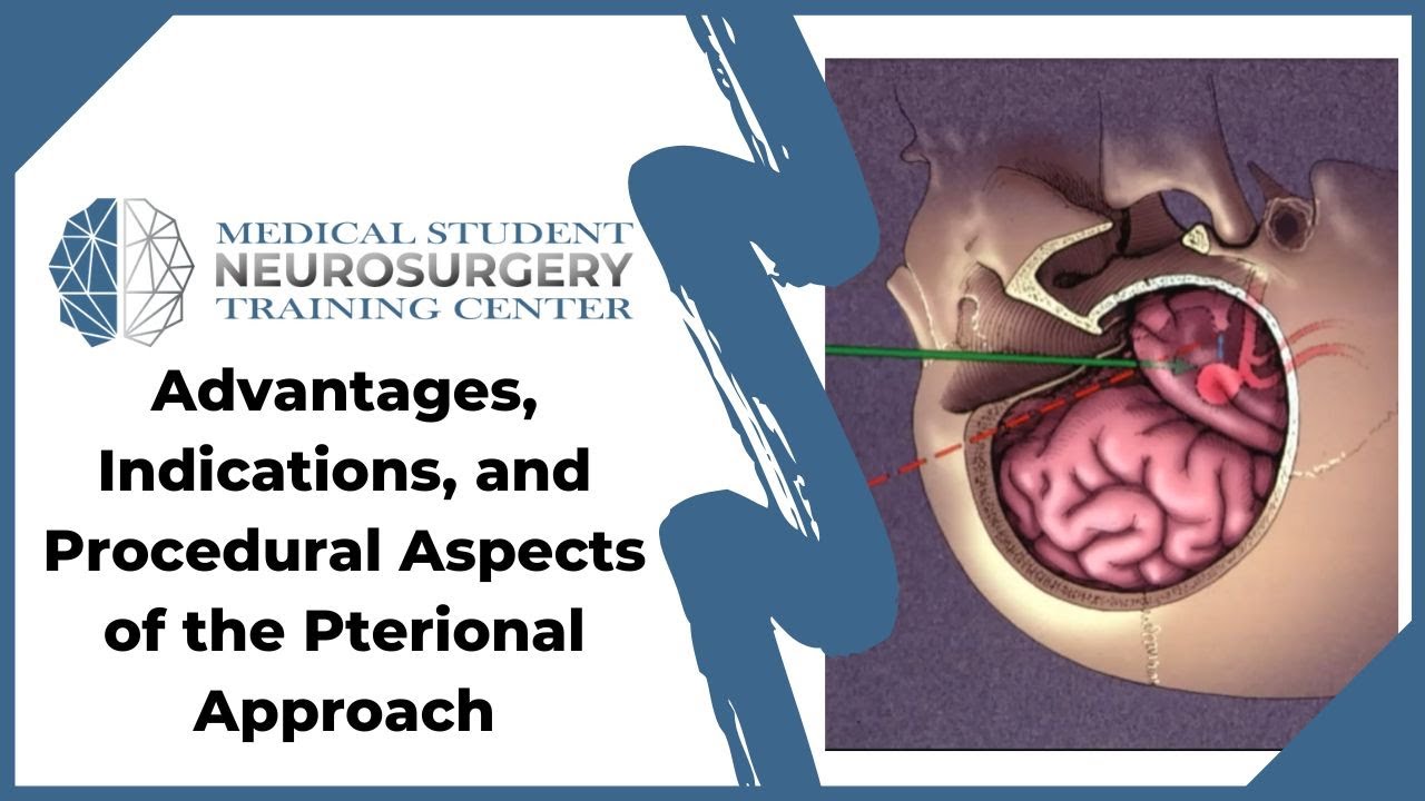 Advantages, Indications, and Procedural Aspects of the Pterional ...