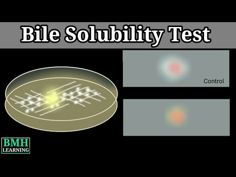 Bile Solubility Test | Streptococcus Pneumoniae Biochemical Test ...