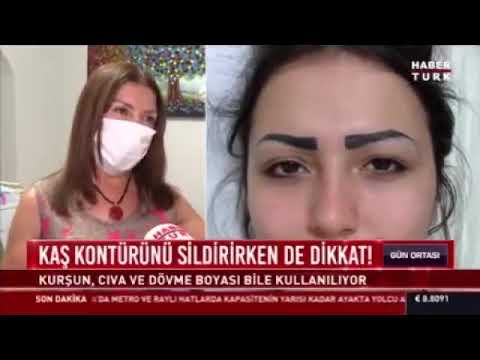Habertürk Haberlerde  Ayten Kömürcü Kaş Silme Hakkında Konuşuyor