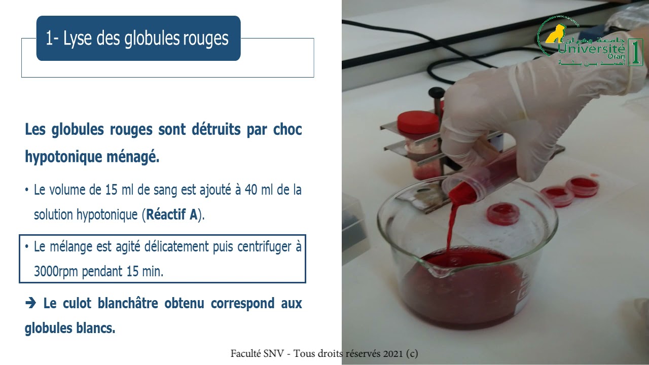 Extraction d’ADN à partir de sang total - YouTube