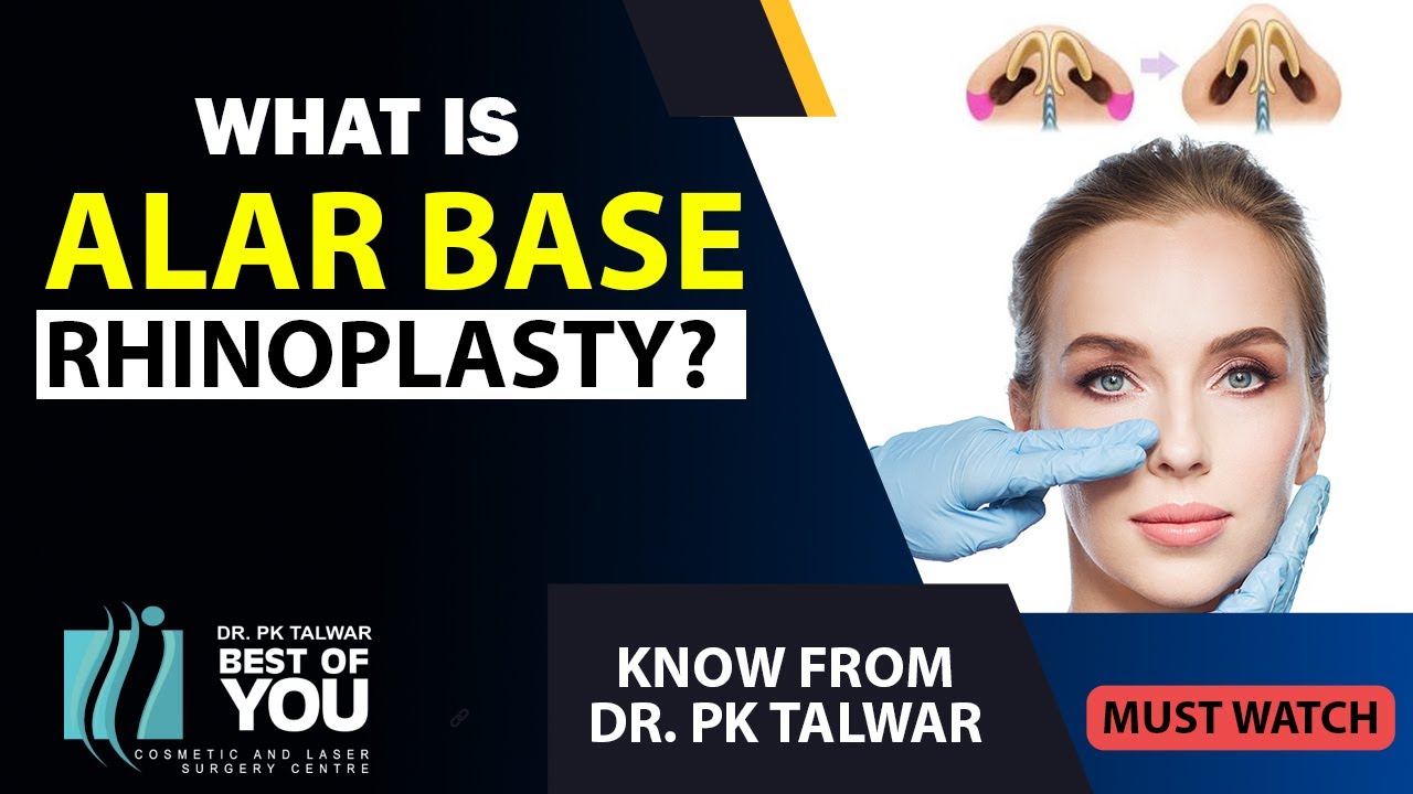 Alar Base Rhinoplasty in India, Alar Base Augmentation by Dr. PK Talwar ...