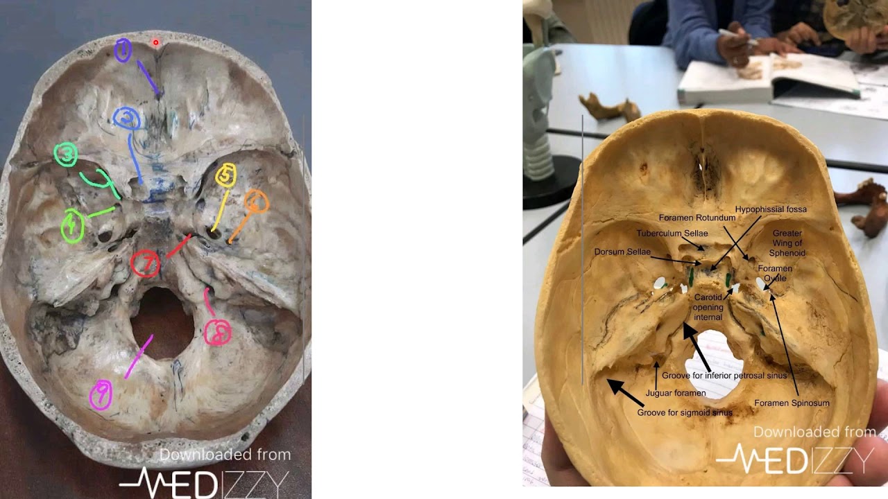 Exocraneo y Endocraneo - YouTube