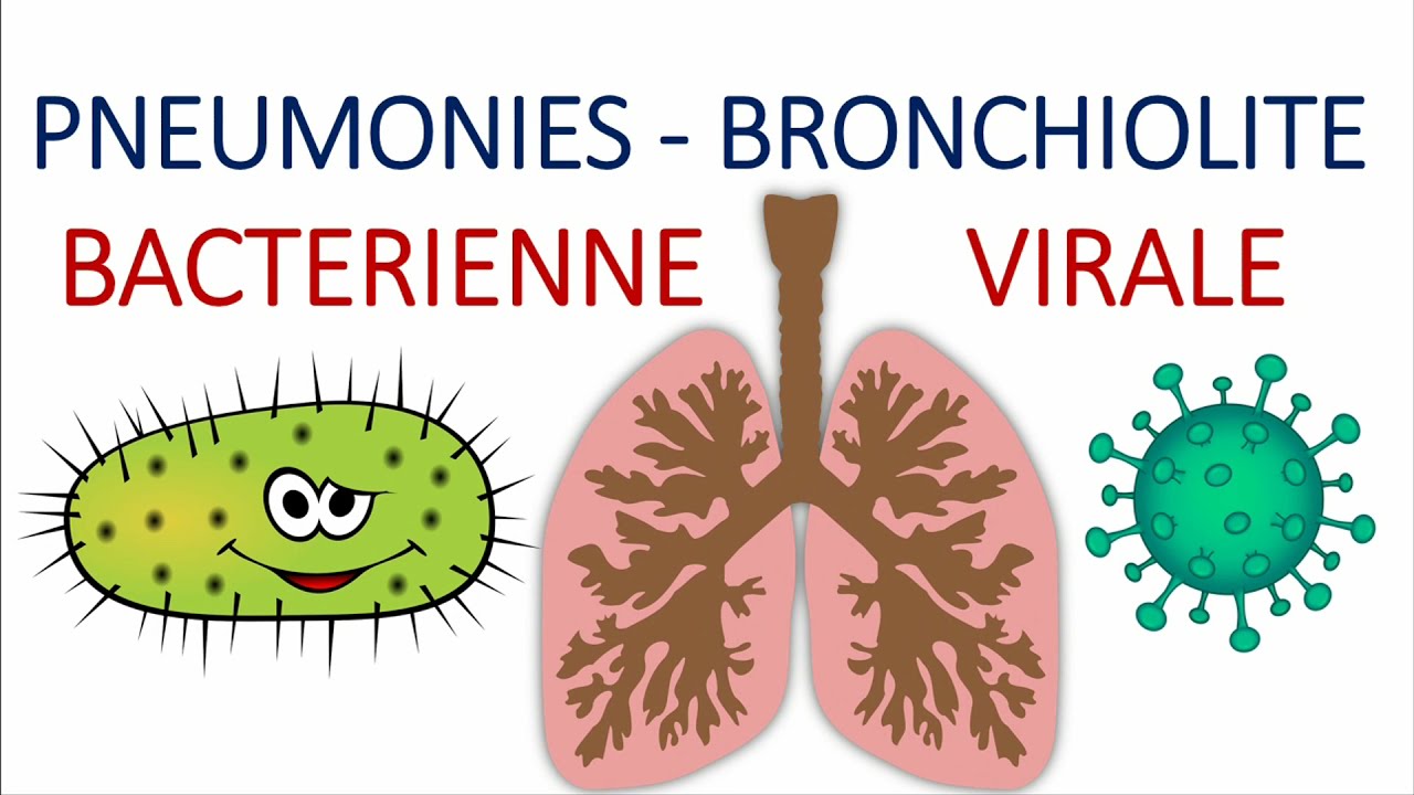 Comment différencier entre une pneumonie aigue communautaire ...