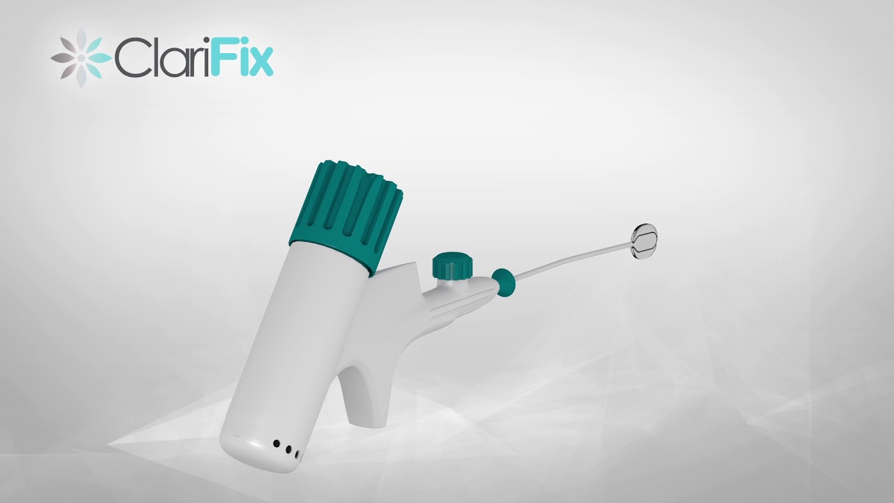 ClariFix | Patient Animation - YouTube