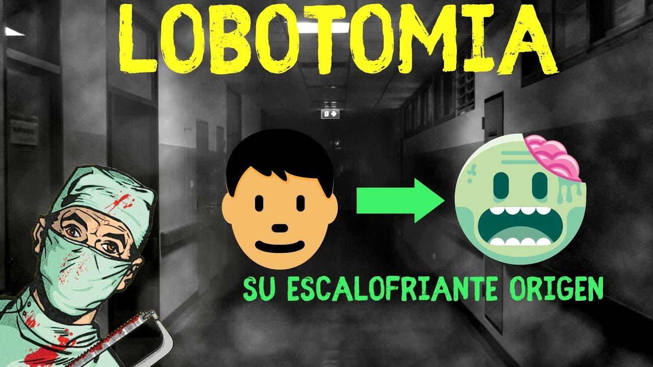La LOBOTOMÍA y su terrorífico origen - YouTube