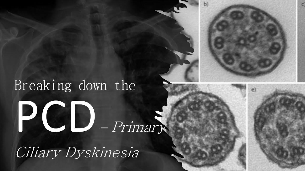 Breaking Down PCD – The INVISIBLE Lung Disease in 55 Seconds! - YouTube