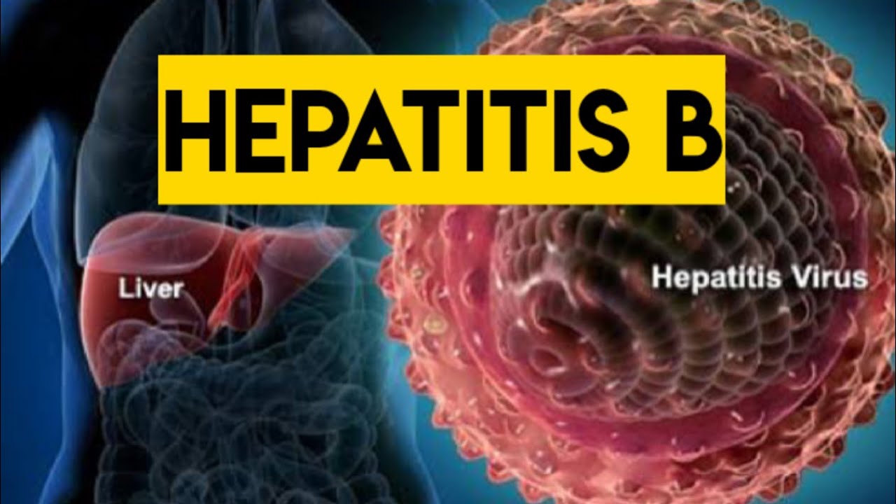 HBV Clinical Course | Diagnosis | Management of Hepatitis B | Dr.Haider ...