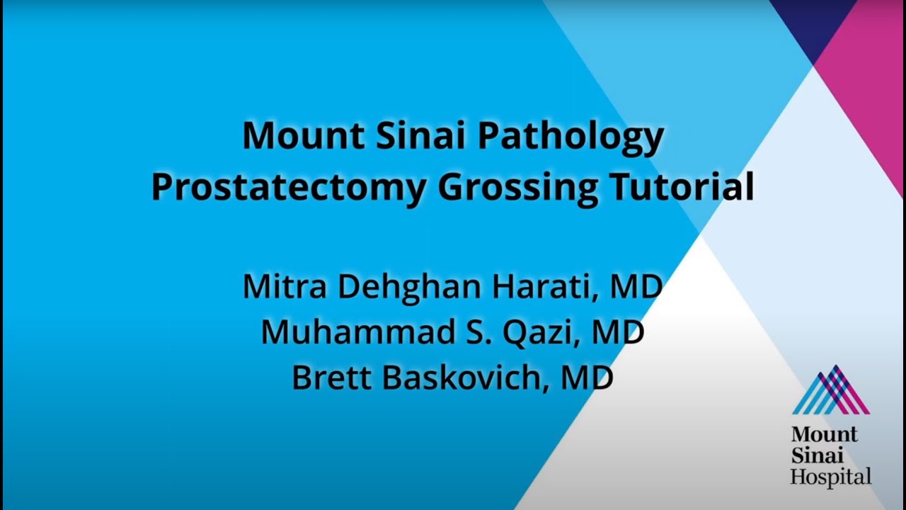 Prostatectomy Grossing Tutorial (Prostate) - YouTube