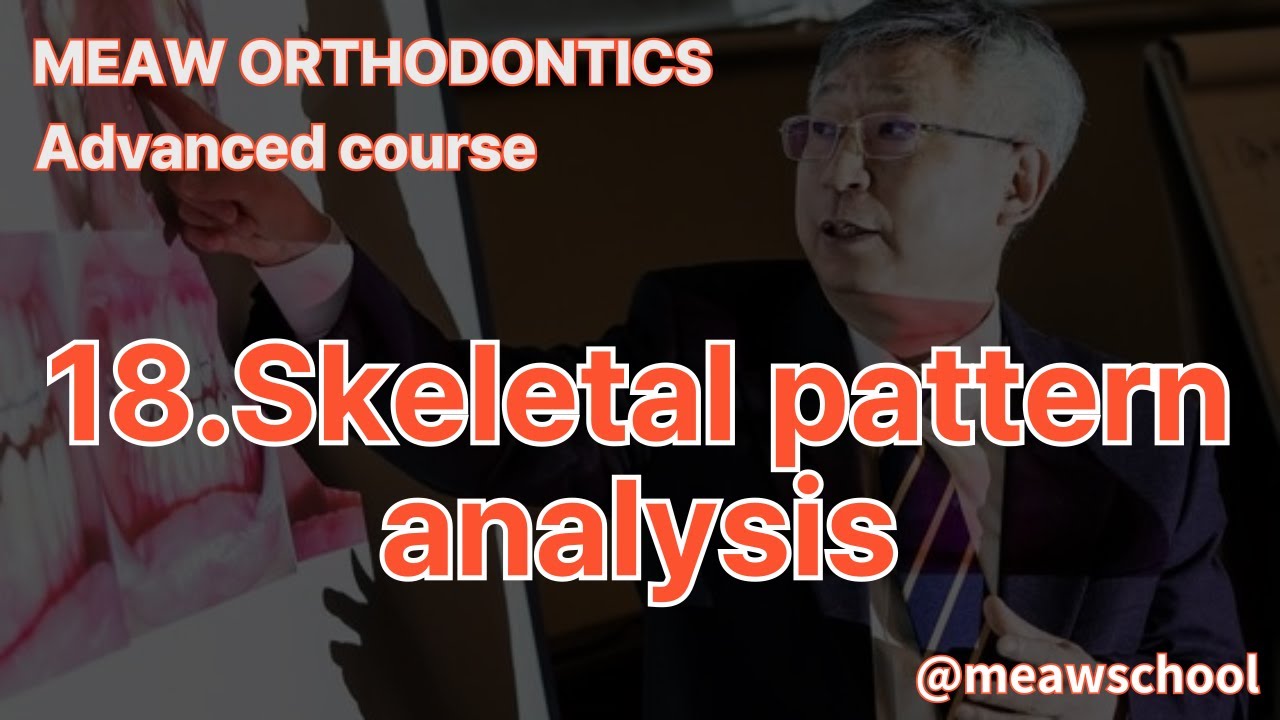 18.Skeletal pattern analysis - YouTube