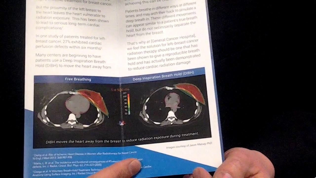Protecting the heart and lungs during radiation therapy - YouTube