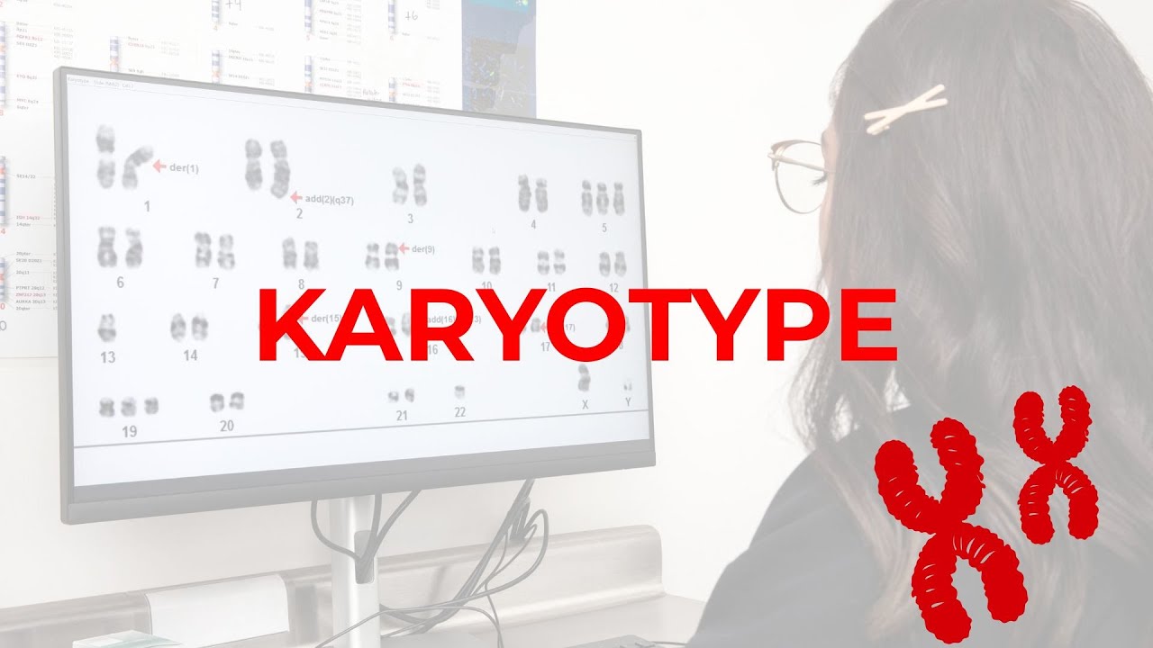 Karyotyping Explained: Step-by-Step Guide to Chromosome Analysis (2025 ...