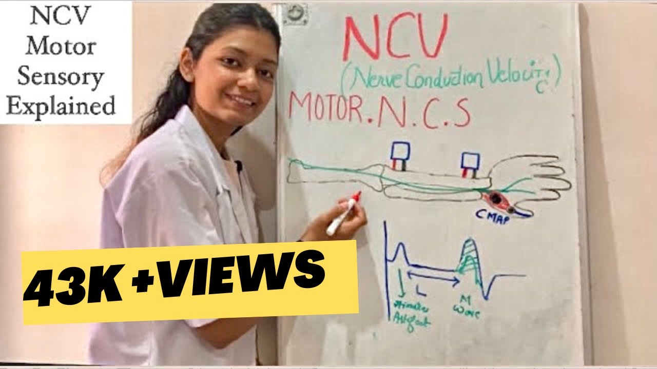 NCV test | Motor and sensory nerve conduction studies explained - YouTube