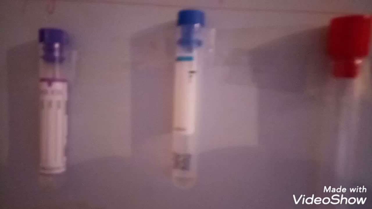 Formule numeration sanguine F.N.S Et demande biologique - YouTube