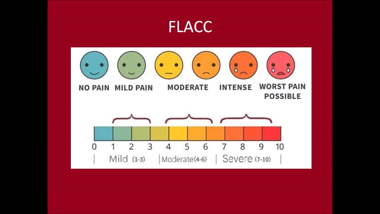 FLACC Scale - YouTube