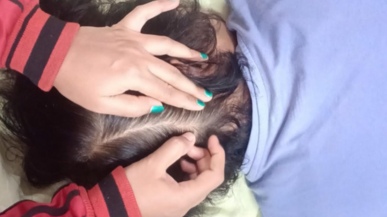 Scalp Check ASMR - The Ultimate Tingle Test - YouTube