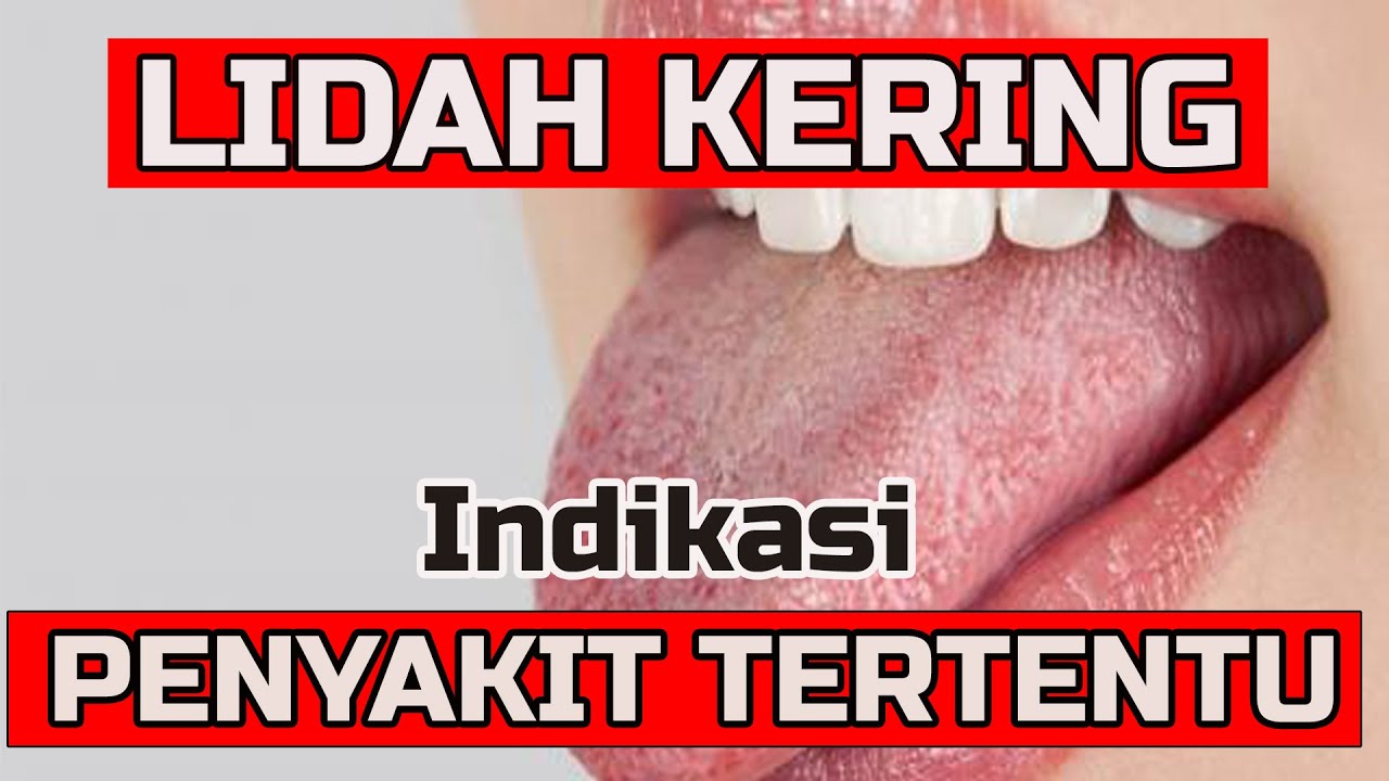 Penyebab Lidah Kering dan Cara Mengatasinya - YouTube