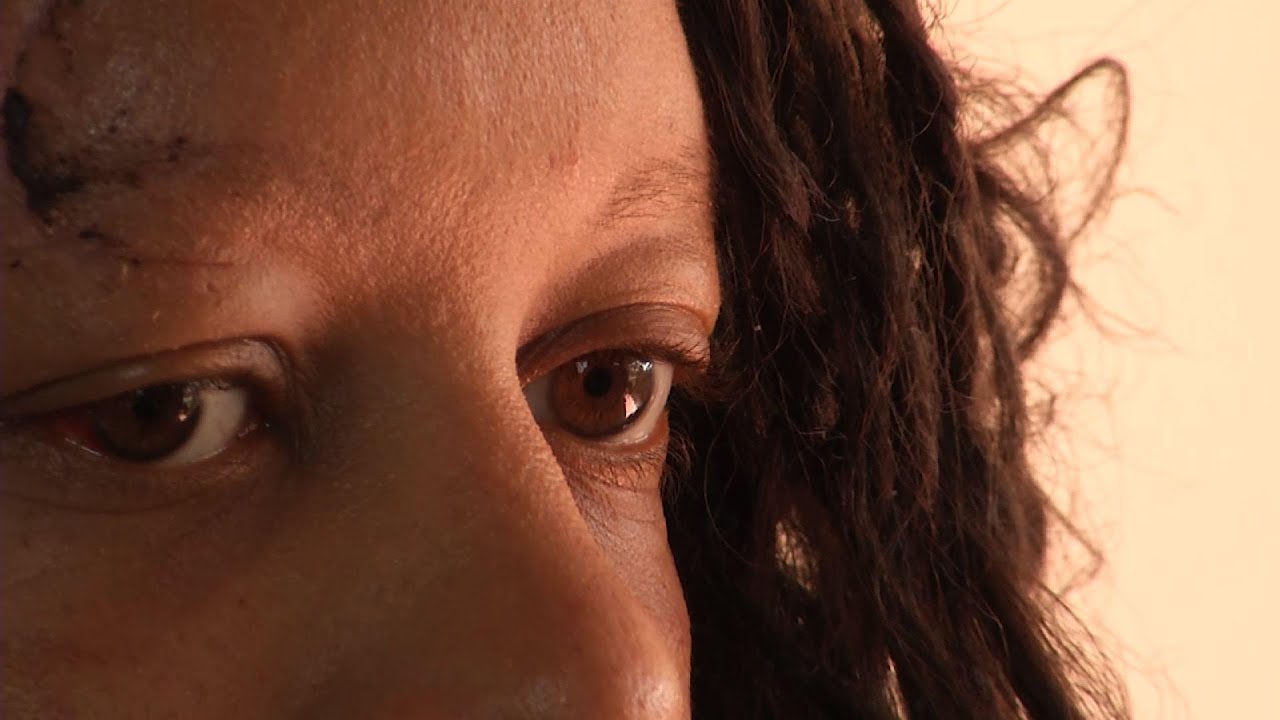 Protester hit in face by police rubber bullet wants answers