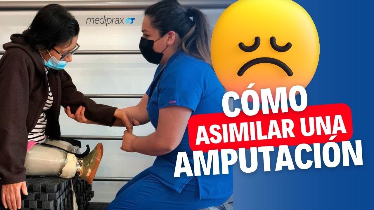 Cómo adaptarse a la pérdida de una extremidad: Aceptar los cambios ...