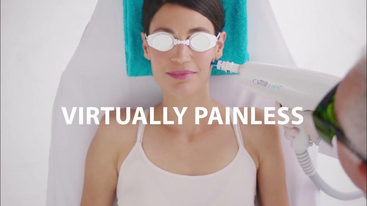 ClearLift by Harmony XL Pro Skin Rejuvenation Laser Treatment - YouTube