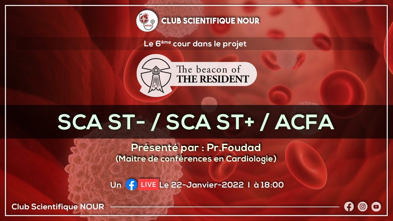 SCA ST- /SCA ST+ /ACFA -||Séance de Révision||présenté par Dr.Foudad ,« The beacon of the ...