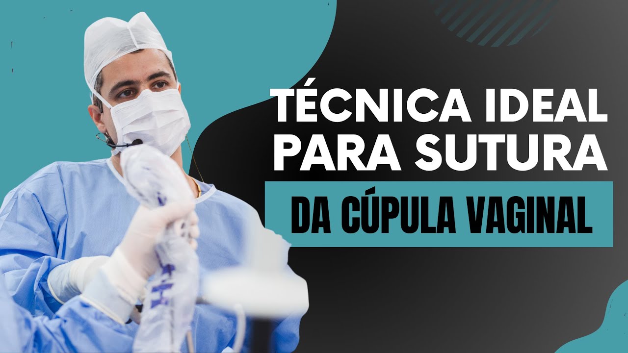 TÉcnica Ideal Para Sutura Da CÚpula Vaginal Youtube