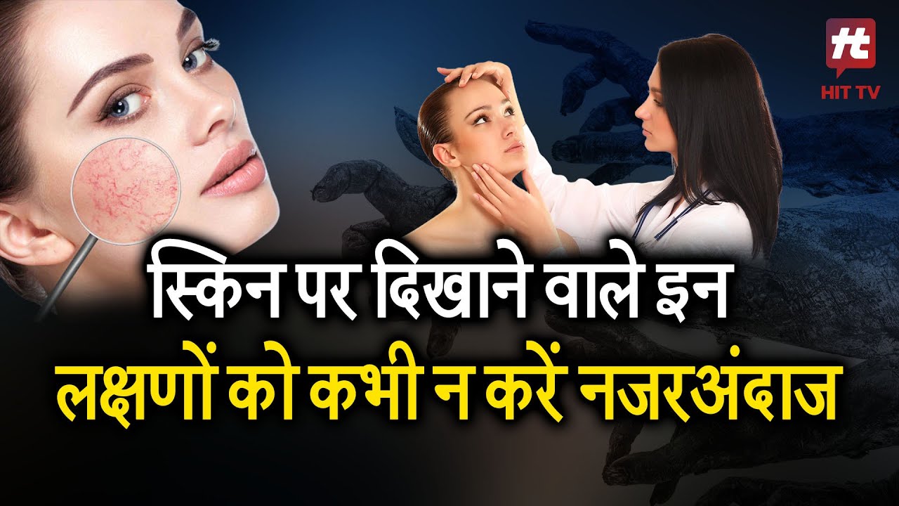 स्किन पर दिखाने वाले इन लक्षणों को कभी न करें नजरअंदाज | Skin Diseases ...