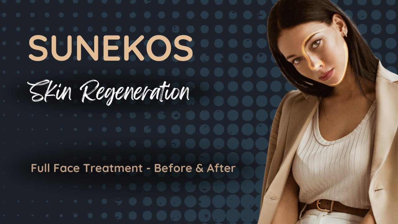Volumize Your Face Naturally - Regenerate with Sunekos - YouTube