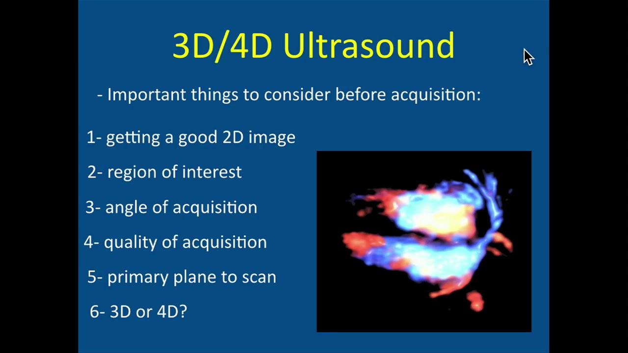 3d 4d Ultrasound In Fetal Echocardiography Youtube