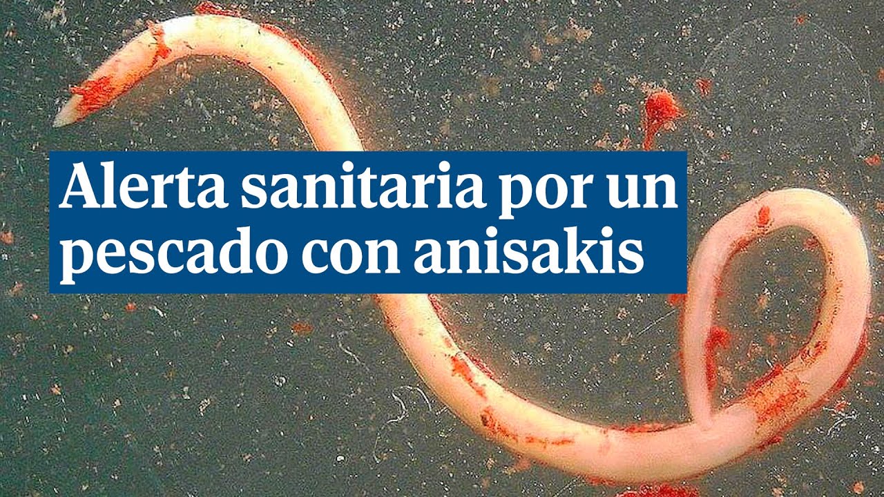 La UE lanza una alerta sanitaria "grave" por un pescado con anisakis ...