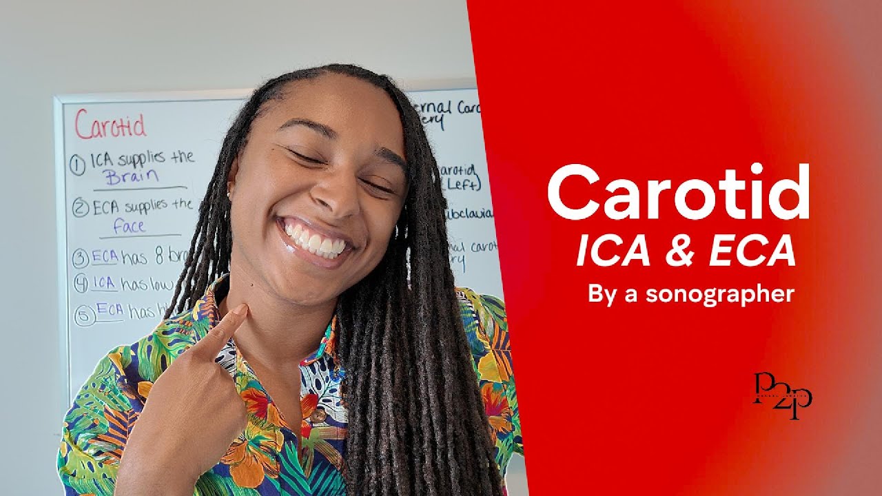 Carotid Artery Anatomy & ICA vs ECA Explained for the Ultrasound Tech # ...