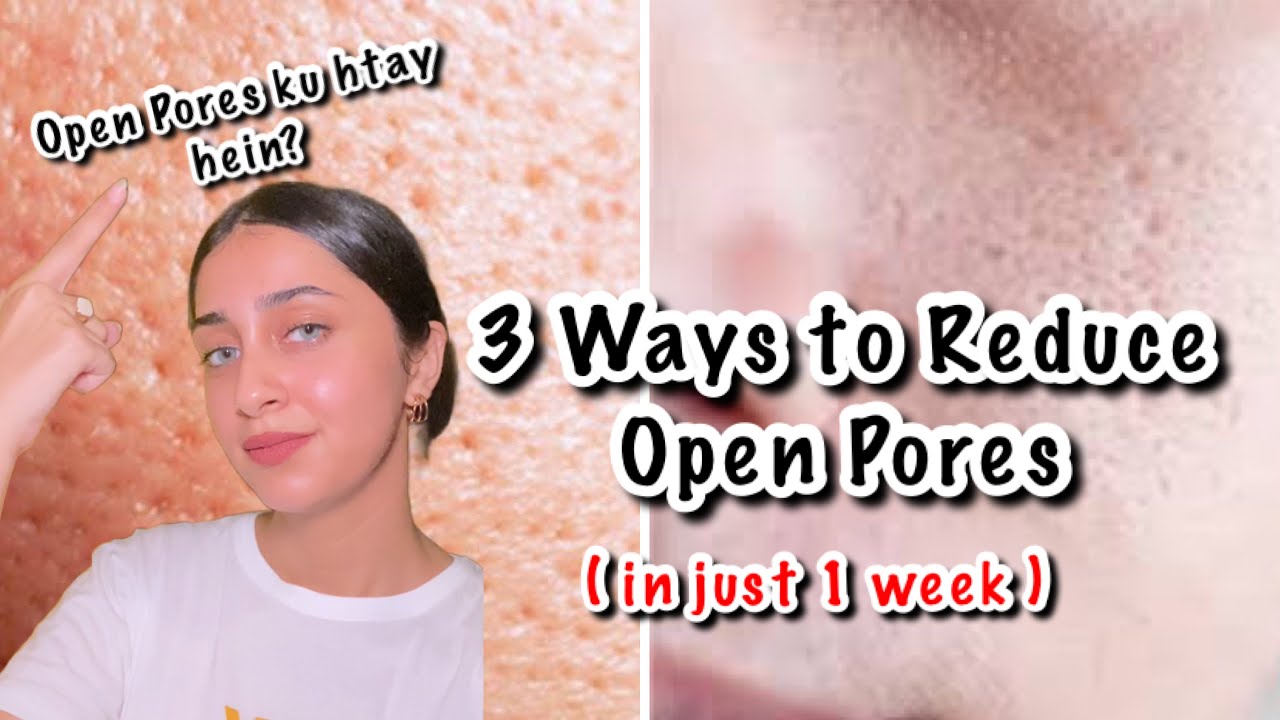 3 Ways to Reduce Open Pores‼️ | Highly Effective and Easy ways to ...