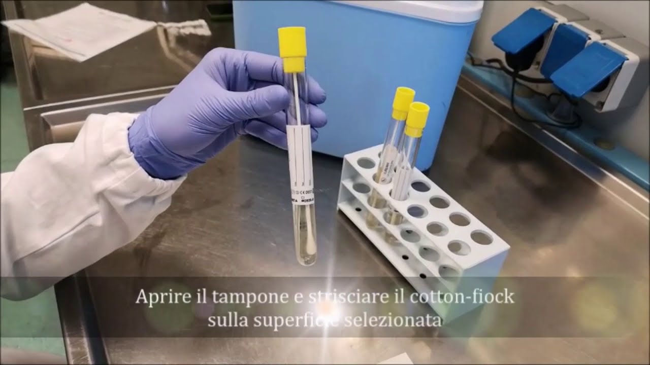 Procedure: come si esegue il campionamento delle superfici con tampone ...