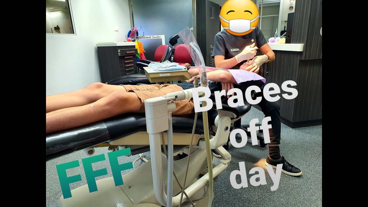 'Braces off' day for James // Orthodontics // Getting that perfect ...