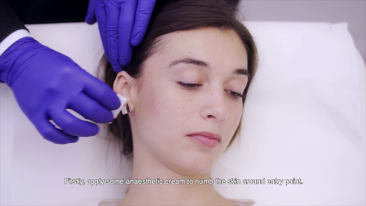 The New Sterimedix GTI Cannula in conjunction with Dr Olivier Amar ...