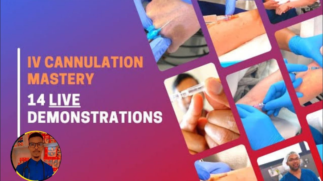 IV CANNULATION MASTERY _ 14 LIVE DEMONSTRATION - YouTube