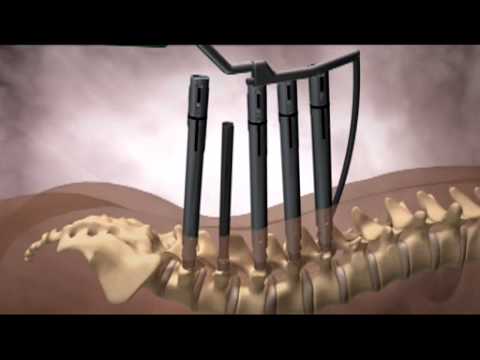 Expedium Viper 2 Advanced Rod Holder Video - YouTube