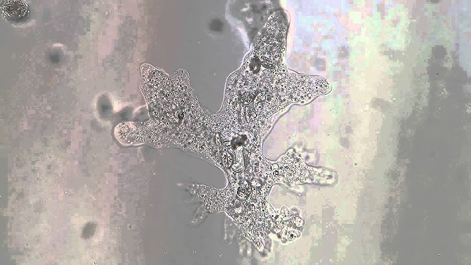 Ameba Proteus Sob Microscopio 100x 3 301 Amoeba Proteus Stock Photos,