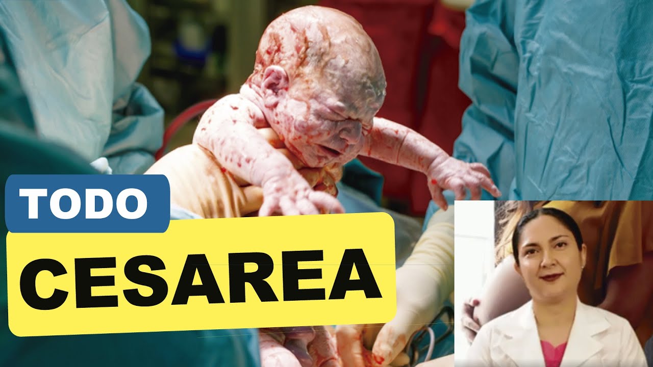 CESÁREA - Preguntas y Respuestas #Guayaquil #Ginecologa - YouTube