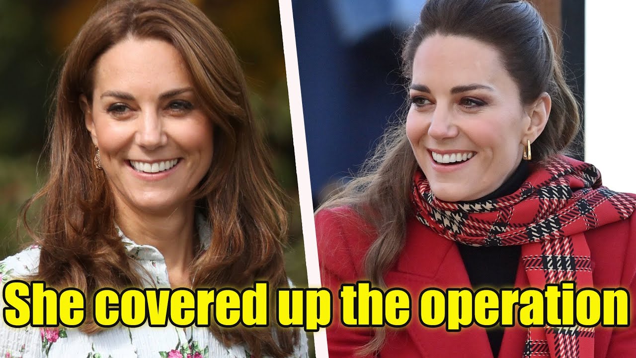 Kate Middleton hid her abdominal surgery from her inner circle - YouTube