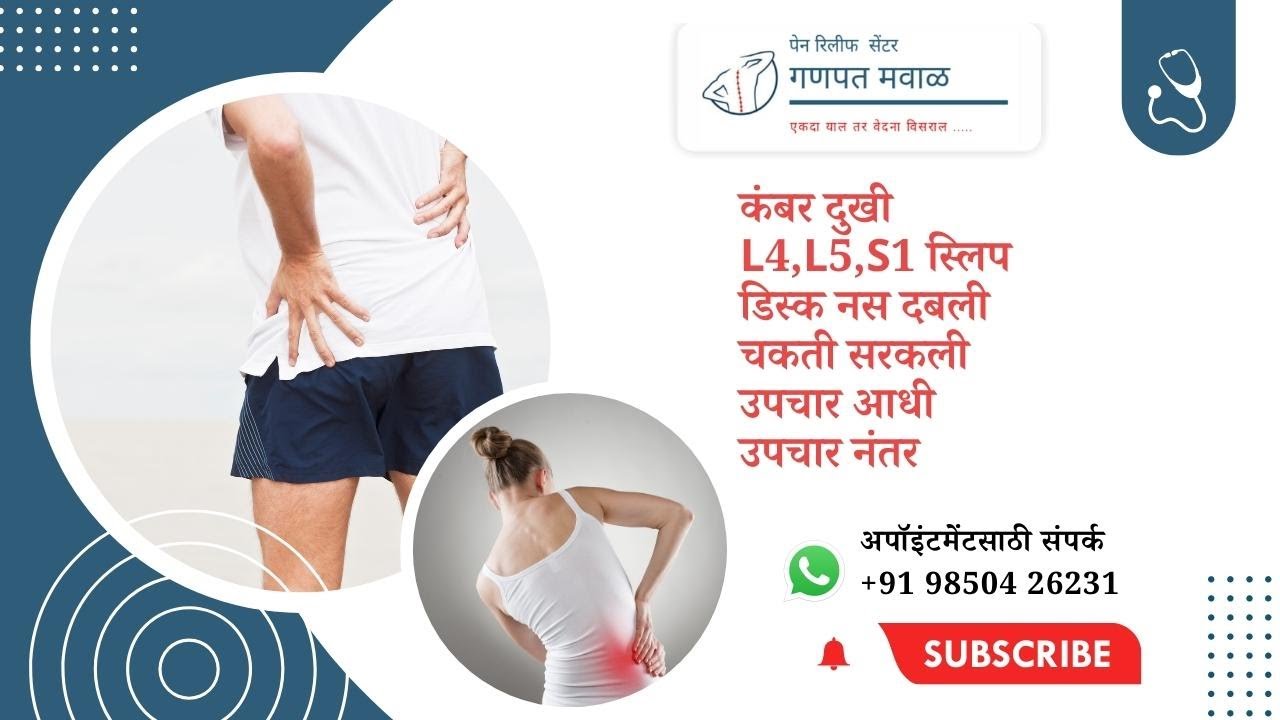 कंबर दुखी L4,L5,S1 स्लिप डिस्क नस दबली चकती सरकली उपचार आधी उपचार नंतर ...