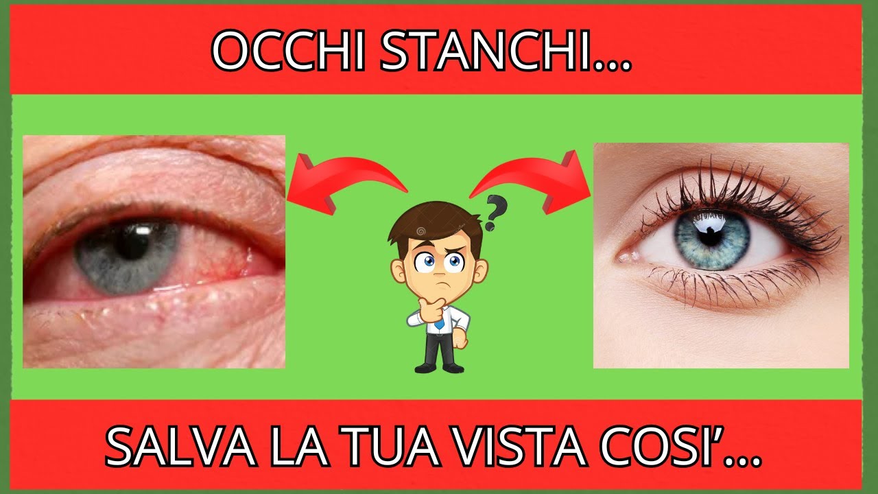 come ridurre la stanchezza oculare: 5 esercizi facili per occhi più ...