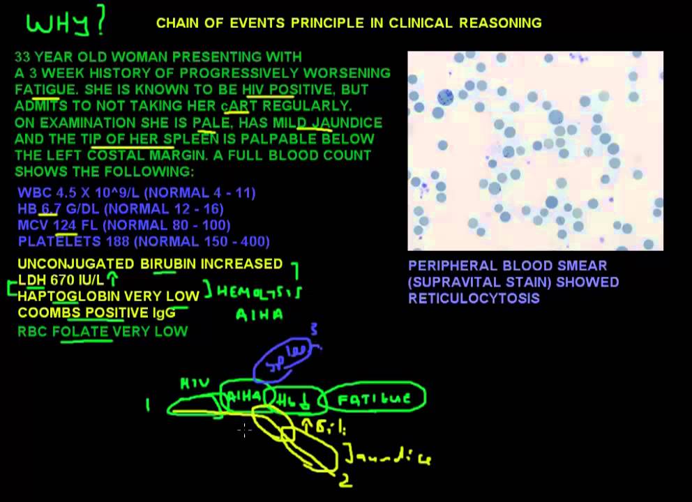 Chain of events principle in clinical reasoning for medical students ...