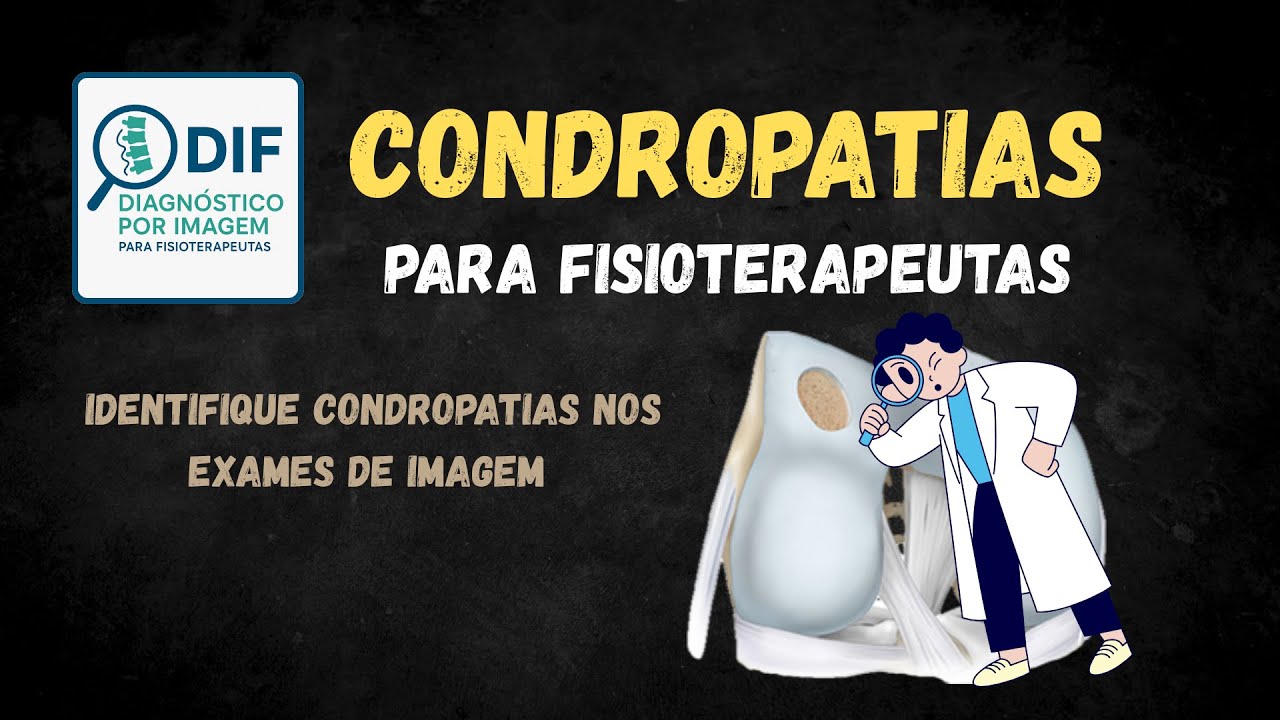 Identifique condropatias nos exames de imagem: para Fisioterapeutas ...