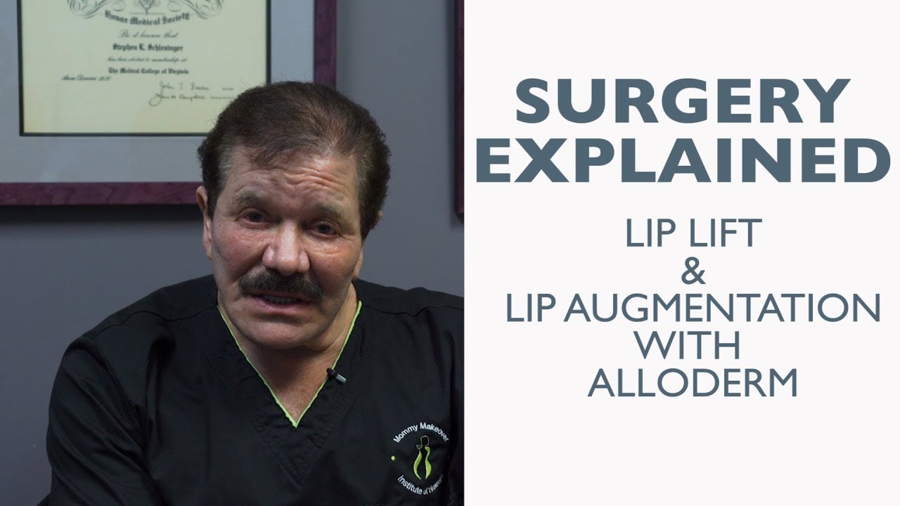 Dr. Schlesinger Explains Lip Lift and Augmentation with Alloderm - Not ...